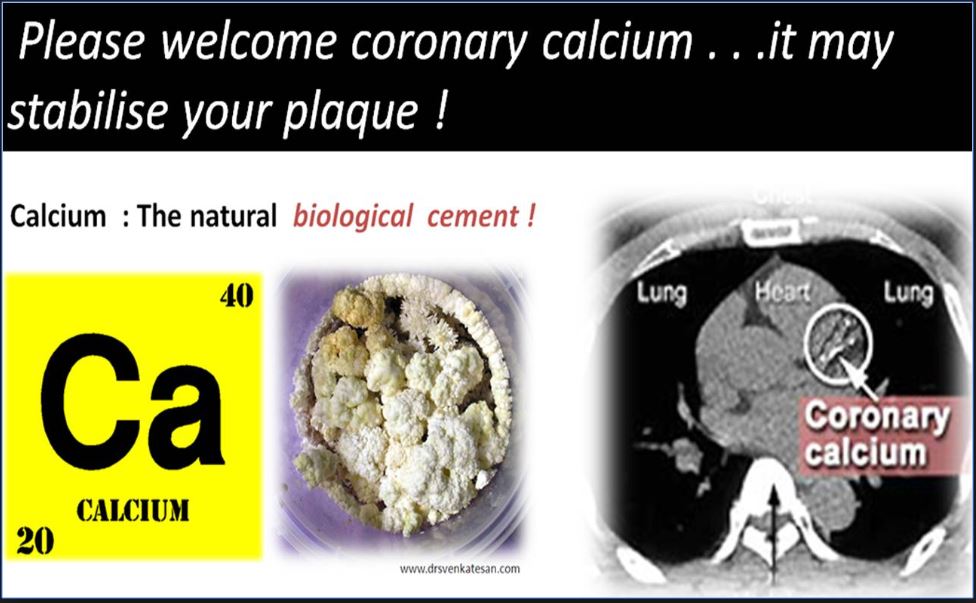 Atherosclerosis and Calcification - Important Paper to Review ! — The ...