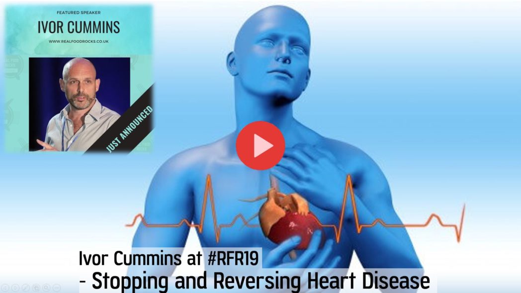 Ep39 Ivor Cummins on Stopping and Reversing Heart Disease at #RFR19 ...